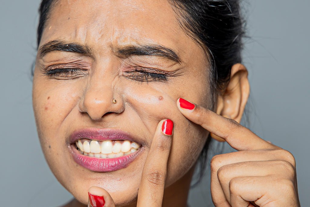 Dry Skin And Acne: Are You Treating It The Right Way? – SkinQ