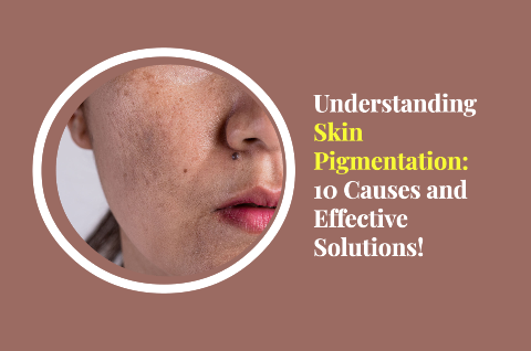 10 Causes of Skin Pigmentation and How to Reduce It? – SkinQ