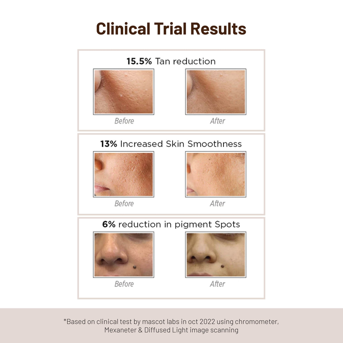 Sunscreen Gel with SPF 40 PA+++ and Vitamin C - SkinQ